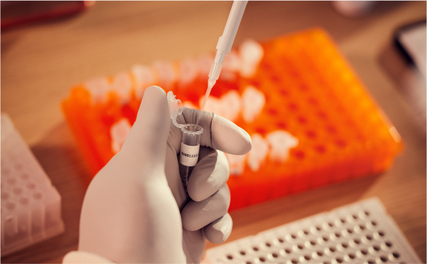 Metatranscriptome Sequencing | Metatranscriptomic analysis